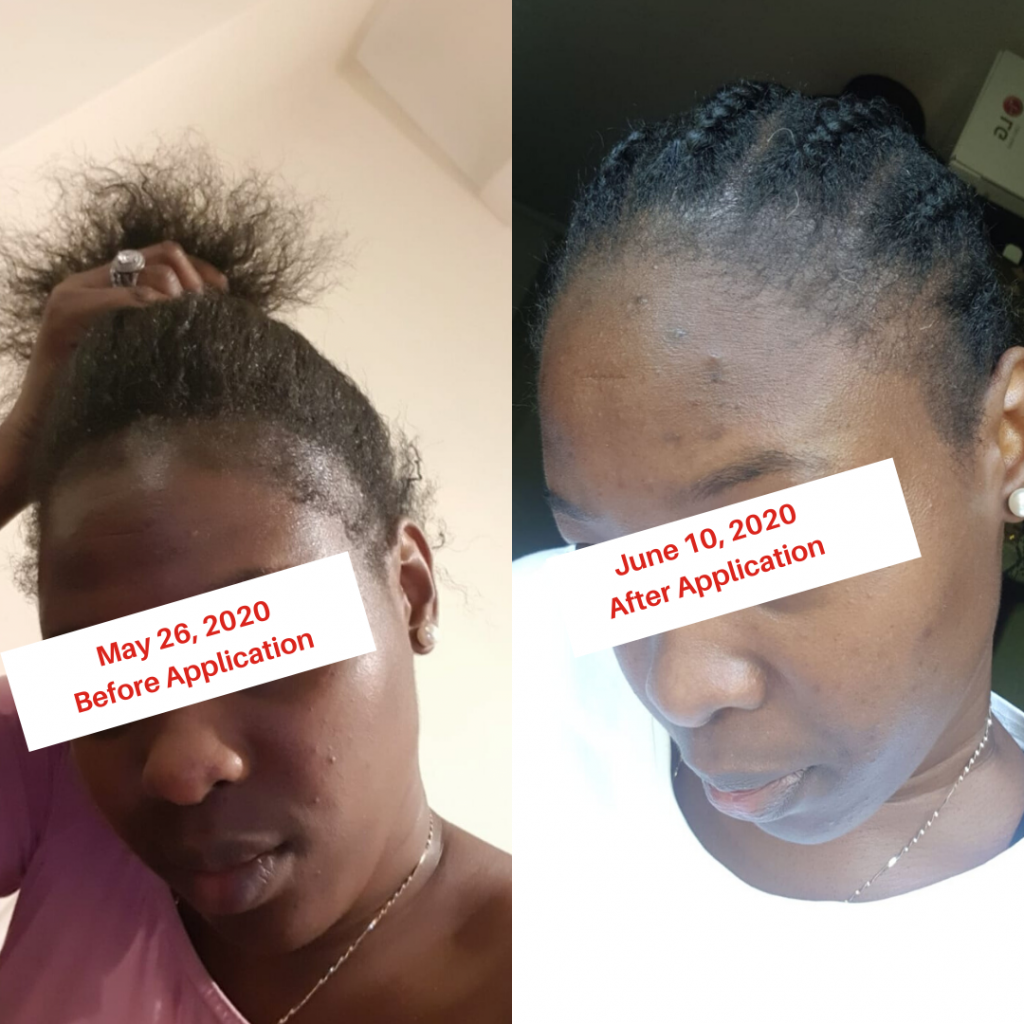 Recover your edges – African Naturalistas Store