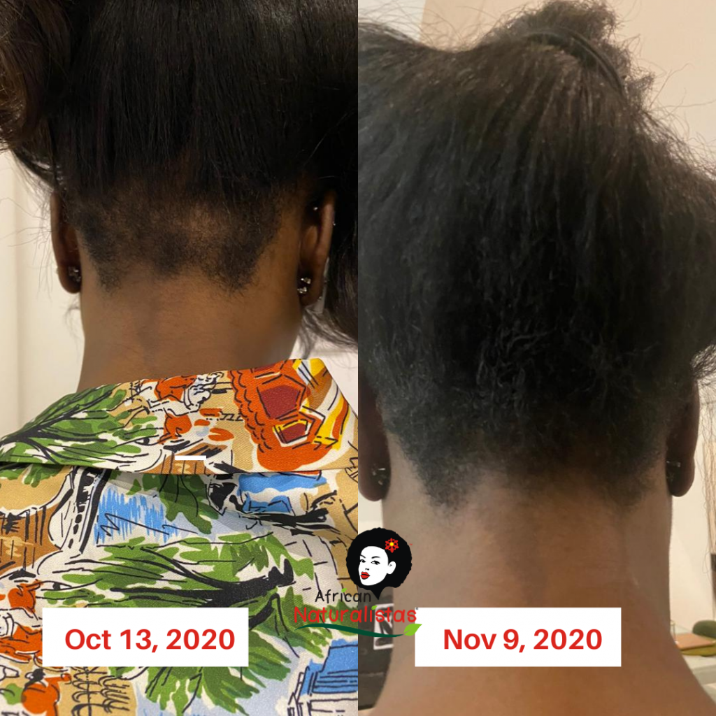 Recover your edges – African Naturalistas Store